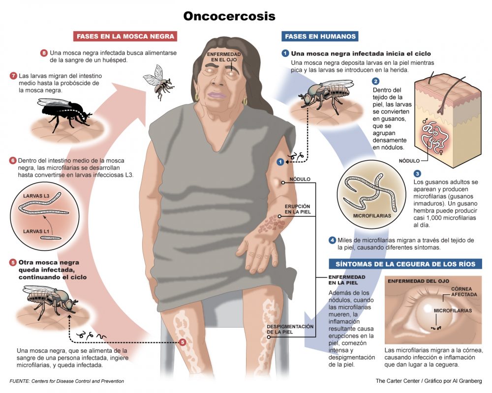 The Life Cycle of River Blindness (Español) – Mectizan Donation Program